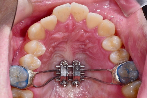 중앙대학교광명병원 | 진료과